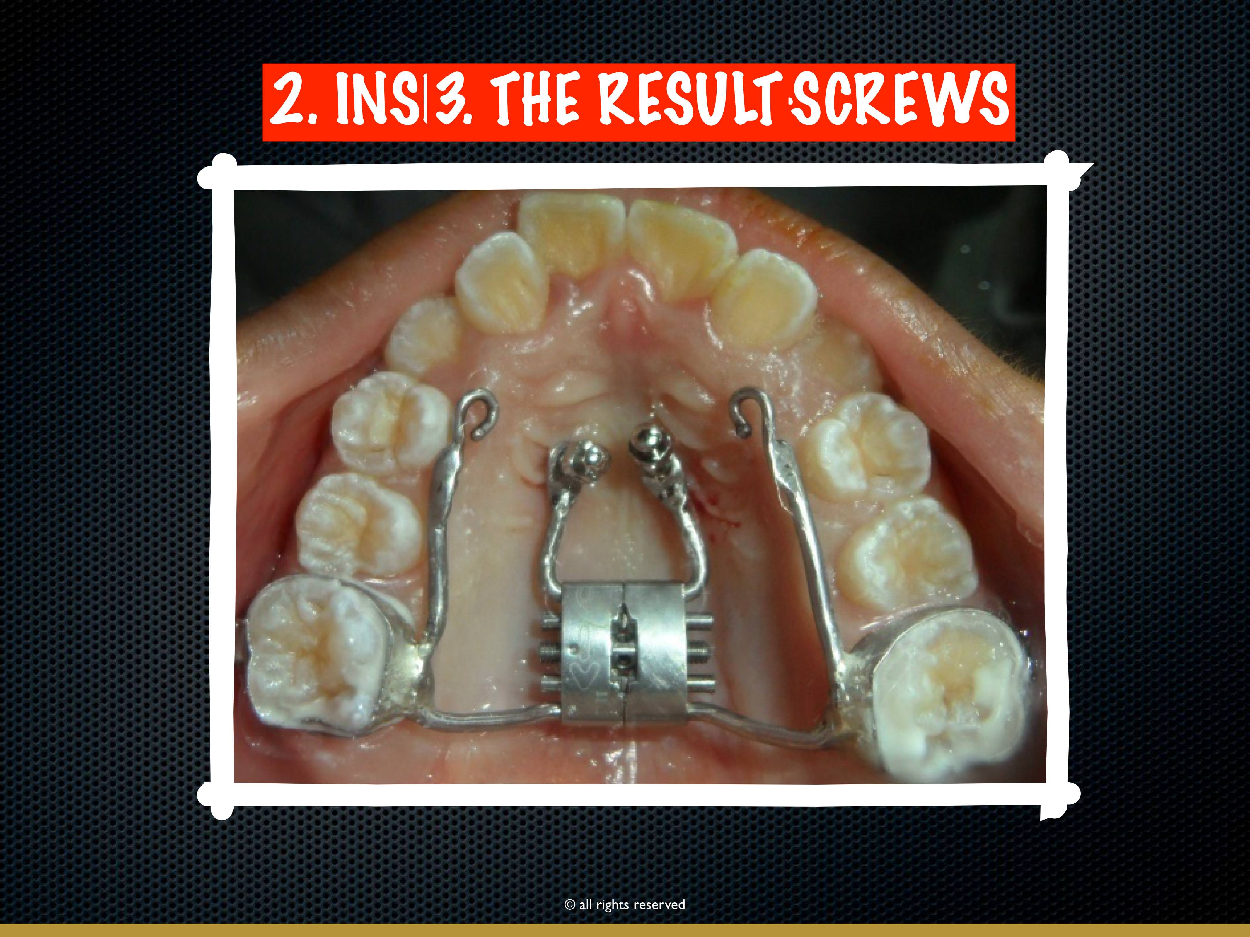 Dr.Patricia's Case-2